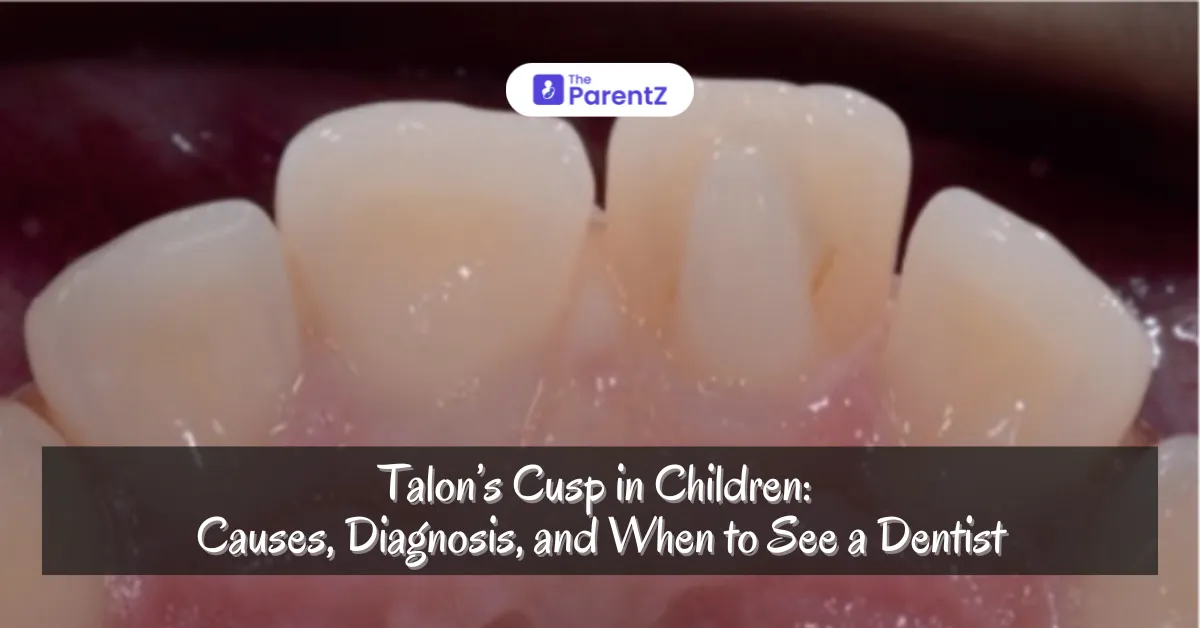 Talon’s Cusp in Children: Causes, Diagnosis, and When to See a Dentist