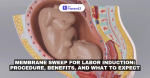 Membrane Sweep for Labor Induction: Procedure, Benefits, and What to Expect