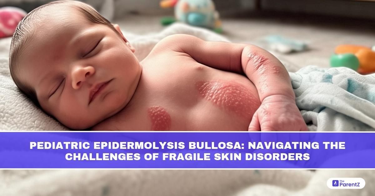Pediatric Epidermolysis Bullosa: Navigating the Challenges of Fragile ...