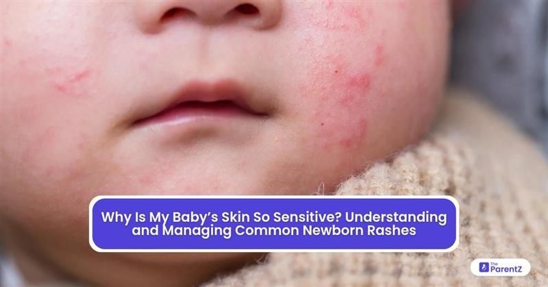 Why Is My Baby’s Skin So Sensitive? Understanding and Managing Common ...