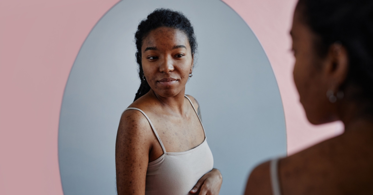 Body Dysmorphic Disorder - The ParentZ