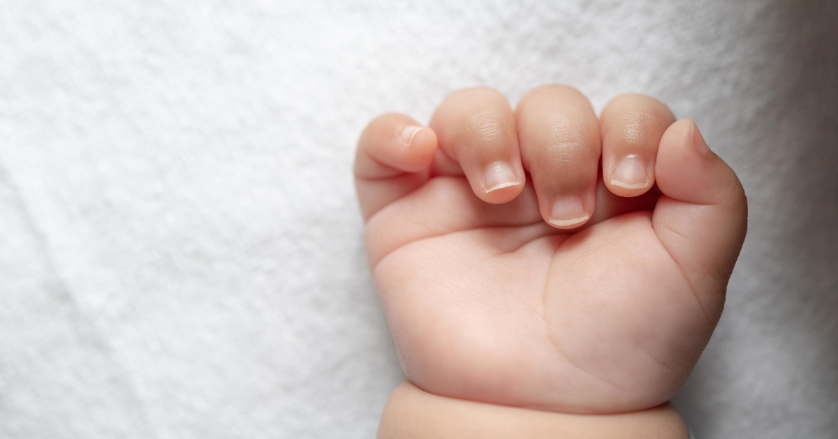 Understanding Your Baby’s Unusual Palm Lines and What They Might Mean ...
